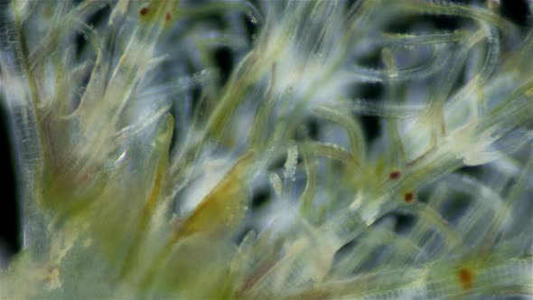 Polychaeta Worm Family Sabellidae Under a Microscope, Stock Footage