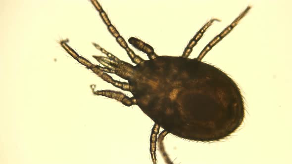 Mite Acari Hypoaspis Under the Microscope, Stock Footage | VideoHive