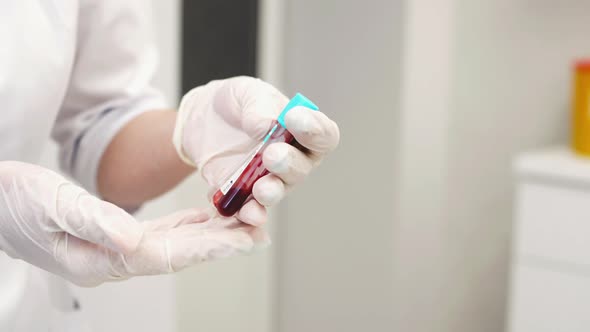 Mixing Blood in Test Tubes, Stock Footage | VideoHive