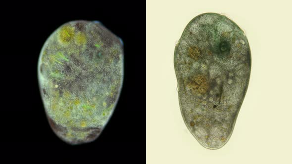 Infusoria Stentor Under the Microscope, the Family Stentoridae, Class ...