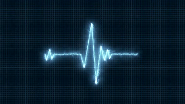 Heartbeat, Motion Graphics | VideoHive