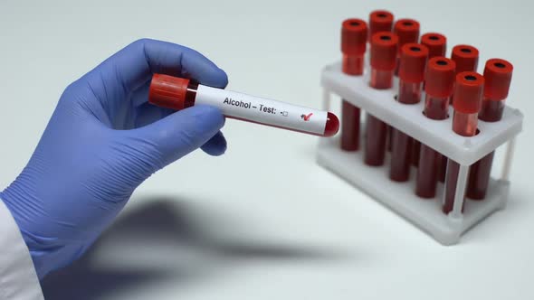 Positive Alcohol Test, Doctor Showing Blood Sample, Lab Research ...