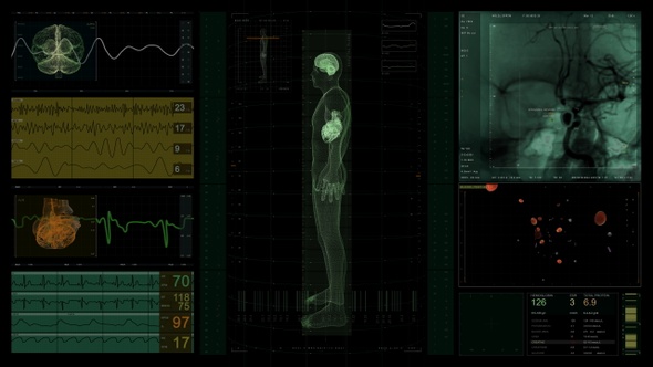 Medical Screen 4K, Motion Graphics | VideoHive