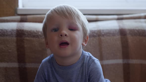 Childhood, Little Cute Child with Trauma on His Face and Black Eye ...