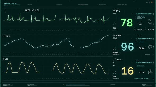 Interface Of Heart Rate Test Equipment Analyzes And Records Patients ...