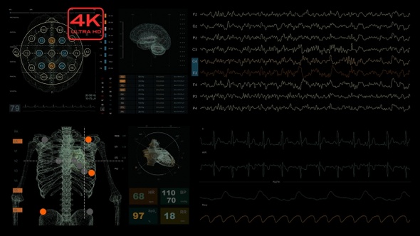 Medical screen. ECG. EEG. 4K, Motion Graphics | VideoHive