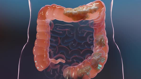 Anatomy of the human digestive system, concept of the intestine ...