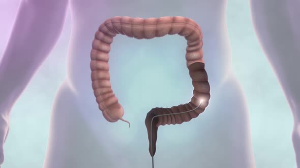 digestive system, colonoscopy animation hd, Motion Graphics | VideoHive