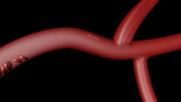 Animation Red Formation Thrombus Healthcare Medical, Motion Graphics