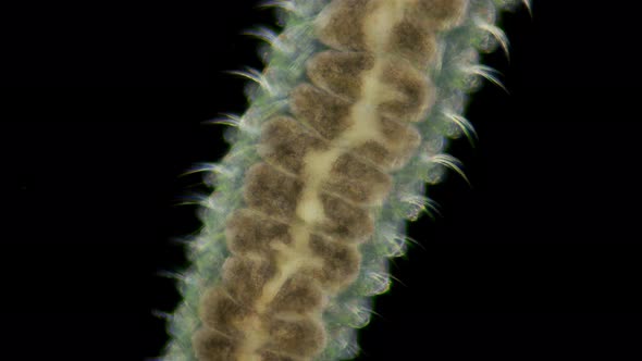 the Middle Part of the Body of the Late Larva Is a Necochet, a ...