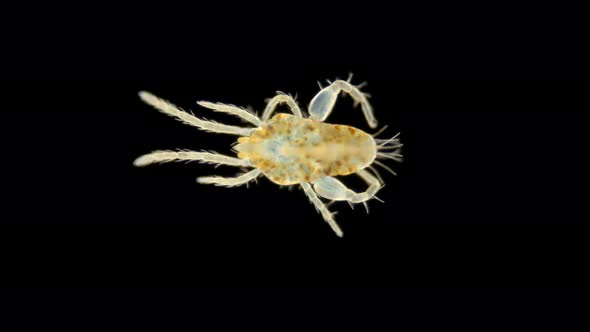 Tick Under the Microscope, Family Eupodoidea, Order Trombidiformes ...