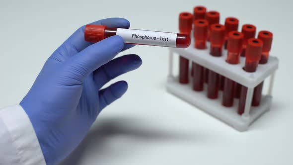 Phosphorus, Doctor Showing Blood Sample in Tube, Lab Research, Health ...