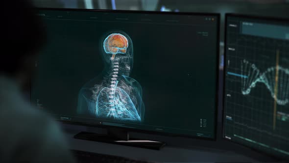 Patients Brain Anatomy Diagnosis Via Rotating Interface Computer System ...