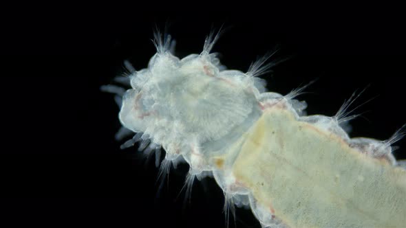 Worm Polychaeta Family Amphinomidae Under a Microscope, Stock Footage