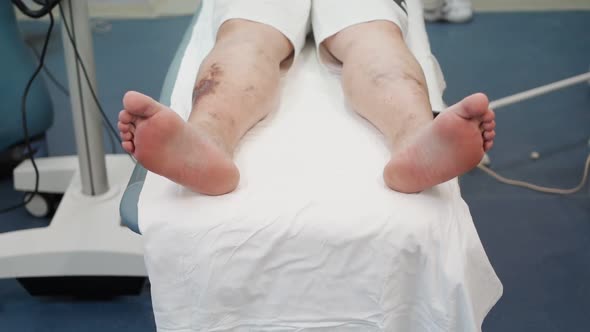 Patient with Frostbite Leg Lies on an Operating Table in Hospital ...