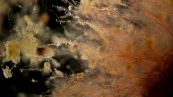 Tick(mite) Living in Water Under a Microscope, the Superfamily ...