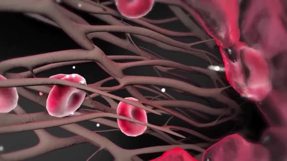 SCAD; is an emergency that occurs when a tear occurs in a blood vessel ...