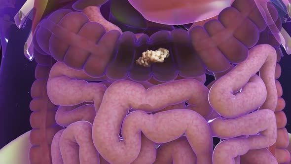 Digestive System2.mov, Motion Graphics | VideoHive