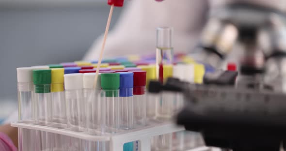 Scientist Chemist Examining DNA Sample From Cotton Swab Under ...