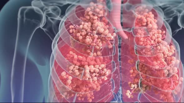 Respiratory system Alveoli 3d anatomy, Motion Graphics | VideoHive