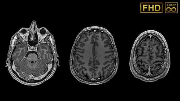 Mri Brain Overhead Slow Detailed, Motion Graphics | VideoHive