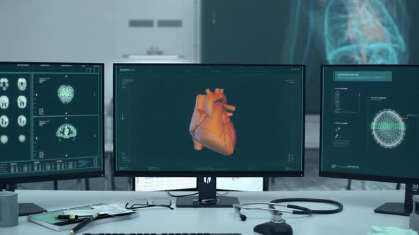 Computer monitoring system finds fatal blood clots in the patients ...