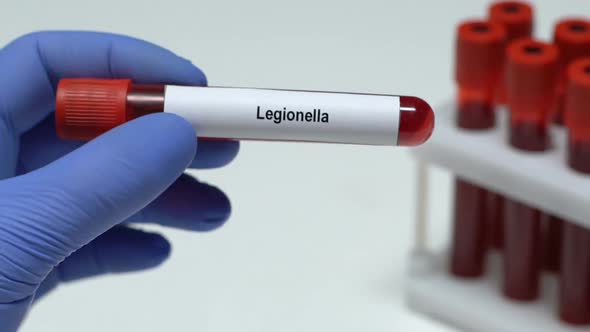 Legionella, Doctor Holding Blood Sample in Tube Close-Up, Health Check ...
