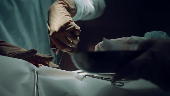 Surgeon Hands Using Clamp Operating Room Closeup, Stock Footage | VideoHive