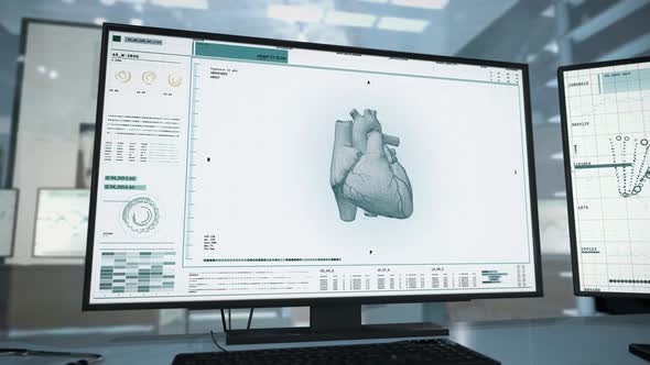 Heart Diseases Monitoring By Futuristic Organ Scanner Clinic Equipment ...