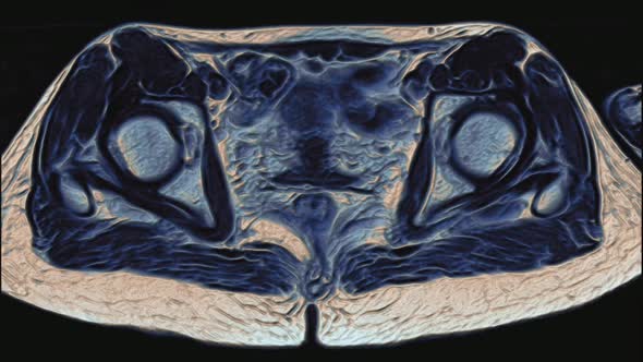 Bulk Multicolored MRI of the Female Pelvic Organs, Abdominal Cavity ...