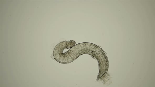 the Typhloscolex sp. worm under a microscope, class Polychaeta, type ...