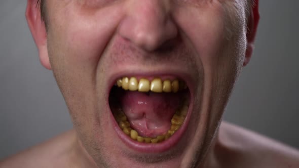 A man with yellow teeth aggressively grins. Negative emotions on the ...