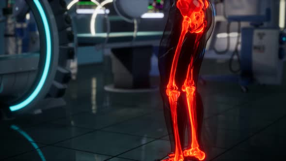 Human Skeleton Bones Scan Exam in Lab, Motion Graphics | VideoHive
