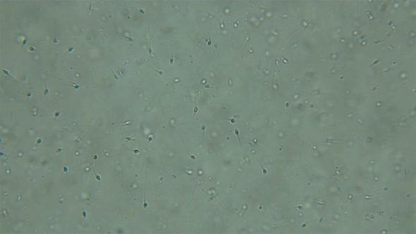Sperm Under the Microscope, the Movement of Sperm Cells in the Seminal ...