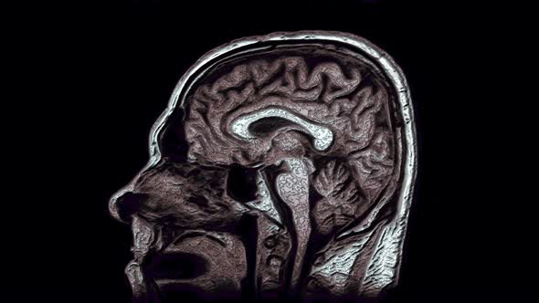 Voluminous Color MRI Scans of the Brain and Head To Detect Tumors ...