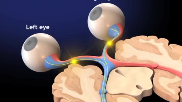 Medical Animation of The Lateral Geniculate Nucleus., Motion Graphics