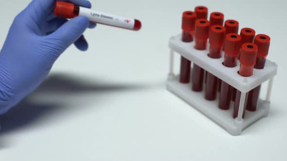 Positive Lyme Disease Test, Doctor Showing Blood Sample in Tube, Health ...