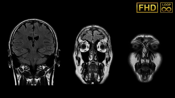 Mri Face Head Brain, Motion Graphics | VideoHive
